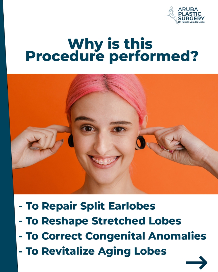 Lobuloplasty or Earlobe Repair at Aruba Plastic Surgery & Aesthetics ...
